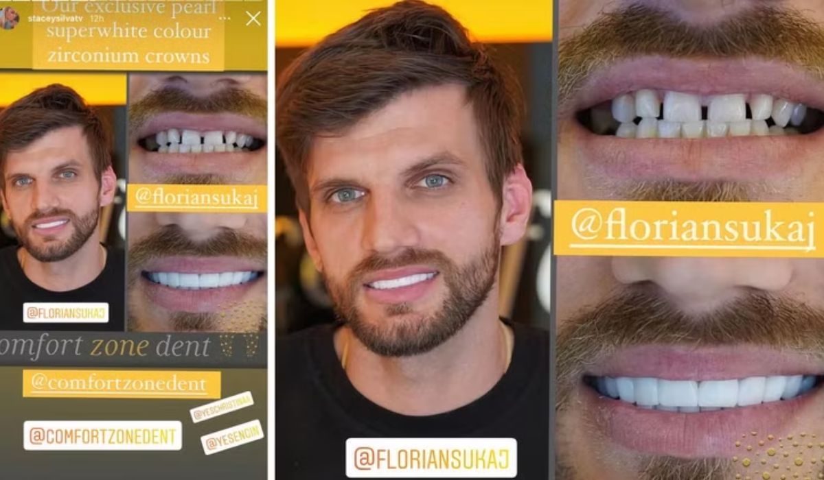 90 Day Fiance: Florian Gets A Fabulous Teeth Makeover, Flaunts Dental ...