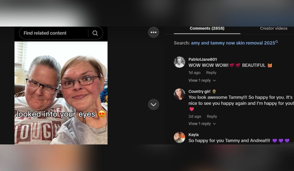1000 Lb Sisters: Fans Can’t Handle Tammy Slaton’s Plastic Surgery ...