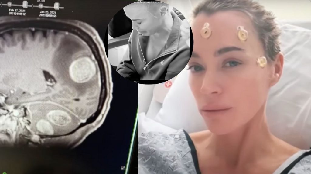 RHOBH: Teddi Mellencamp Reaches Out To Fans For Support During Cancer ...